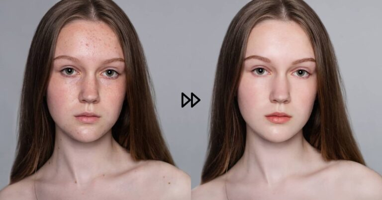 Best Photo Editor for Blemishes - Retouching Labs