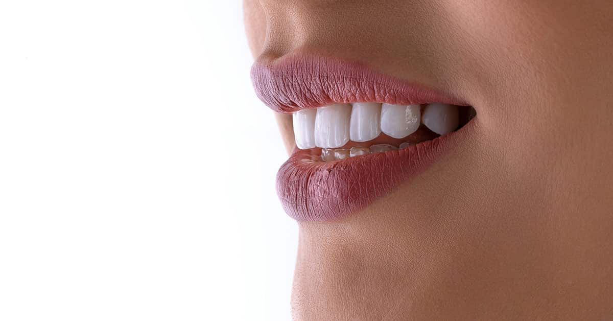Fix Teeth App - Retouching Labs